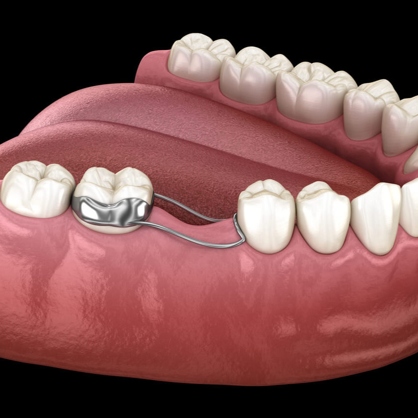 Sugar Bug Buster - Experts Children’s Dental Care San Bernardino